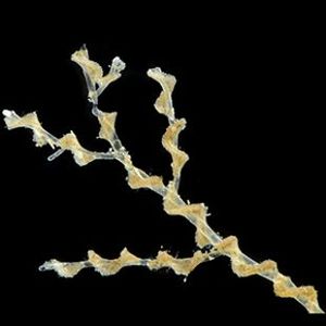 The Biodiversity of Singapore- Amathia sp.